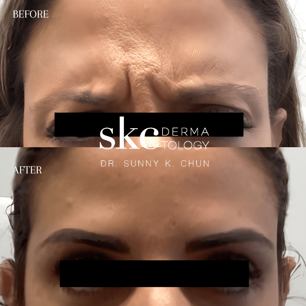 Gallery – SKC Dermatology